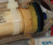 Production of Recombinant Proteins and Monoclonal Antibodies in Hollow ...