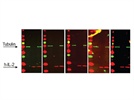 An Automated System to Improve Western Blot Processing | American ...