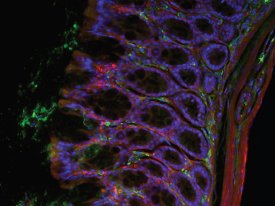 Light-Emitting Diodes: A New Solution for Fluorescence | American ...