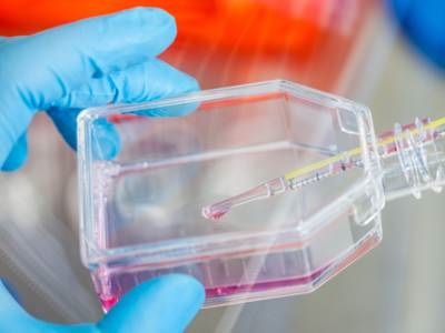 Adherent or Suspension? How to Select the Right Production Method for ...